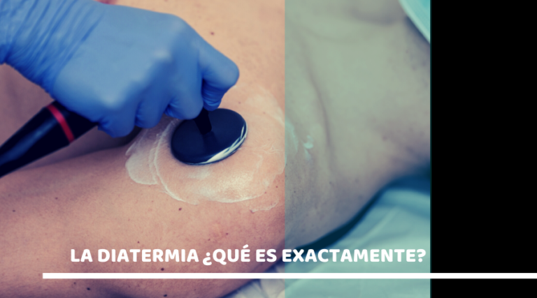 ¿Qué es la diatermia? Beneficios, Propiedades y Contraindicaciones